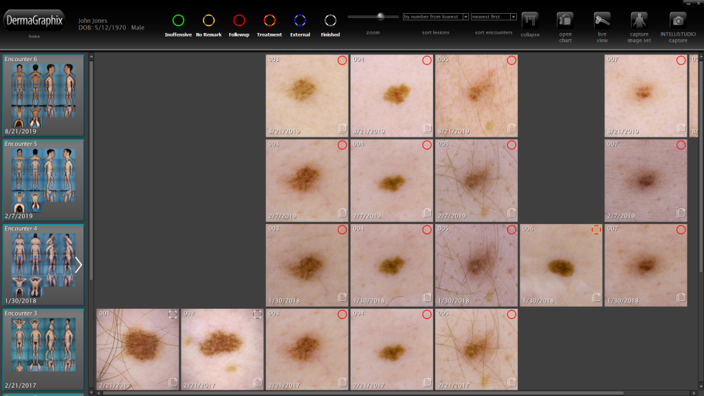 NOWOŚĆ! WIDEODERMATOSKOPOWE BADANIE ZNAMION - Centrum medyczne Stadmedica